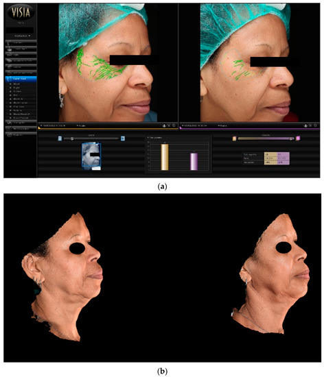 Cosmetics | Free Full-Text | Fluorescent Light Energy (FLE) Generated ...