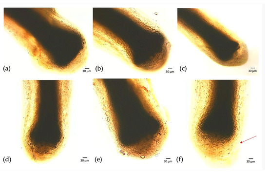 Effectiveness of a Novel Compound HAIR & SCALP COMPLEX on Hair Follicle ...