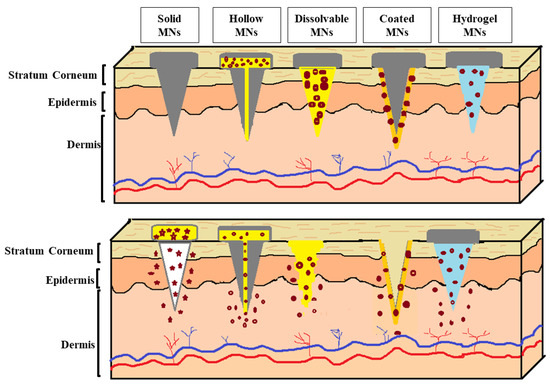 Recent Advances in Microneedling-Assisted Cosmetic Applications