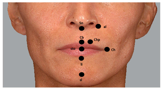 Cosmetics | Free Full-Text | Advancing Lip Augmentation: State-of-the ...