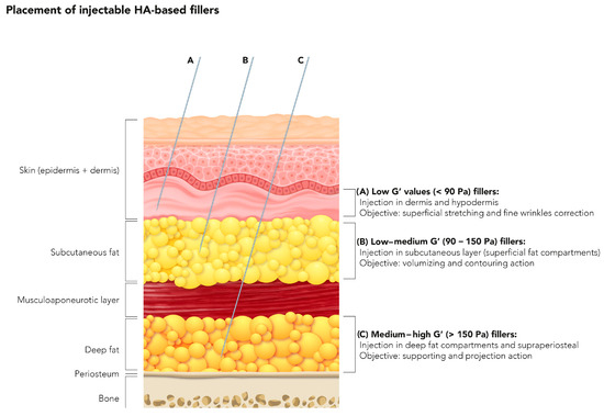 Full Face Tailored Treatments Using Hyaluronan Dermal Fillers: Biophysical Characterization for ...
