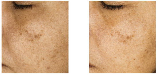 Multifunctional, Novel Formulation for Repairing Photoaged and Sun ...