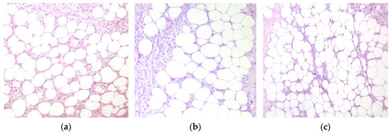 Methods for Chin Area Augmentation: Efficacy Evaluation and Prospects ...