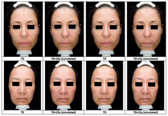 Ethnic Differences in Women’s Perception of Simulated Facial Aging over ...