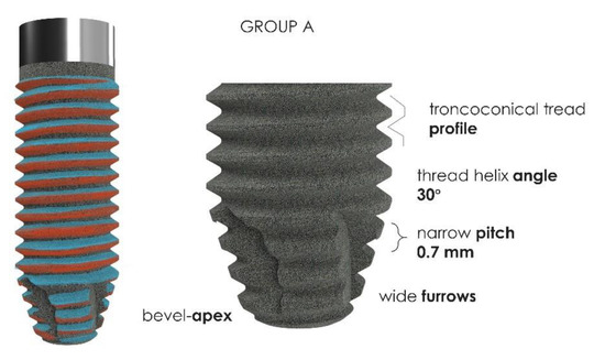 The Effect of Threads Geometry on Insertion Torque (IT) and Periotest ...