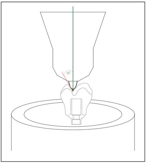 Fatigue Loading Test on Screw-Retained Lithium Disilicate Crowns ...