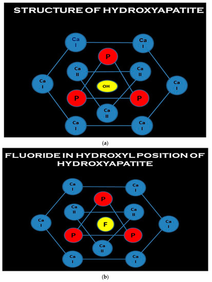 Anticariogenic Sanative Effect of Aluminum Gallium Arsenide Crystals on ...