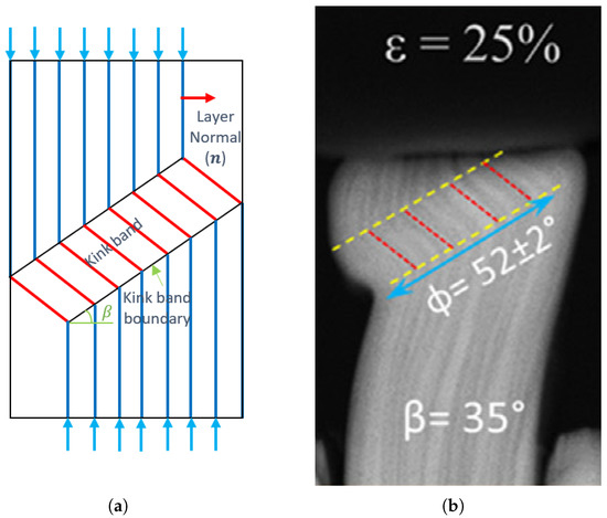 Interface-Dominated Plasticity and Kink Bands in Metallic Nanolaminates