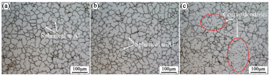 Microstructure and Properties of Semi-Solid 7075 Aluminum Alloy ...
