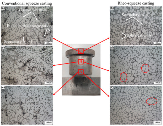 Microstructure and Properties of Semi-Solid 7075 Aluminum Alloy ...