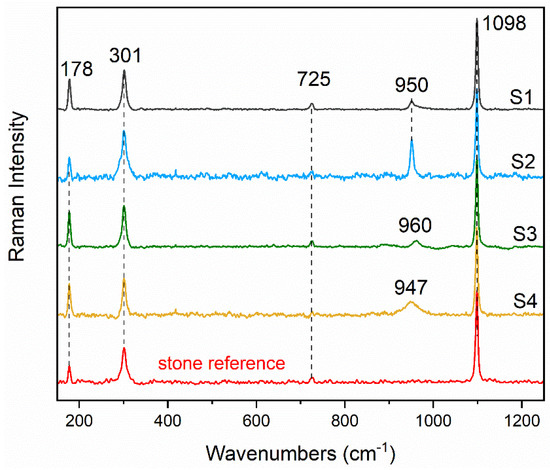 Investigation of Calcium and Magnesium Phosphate Crystals in Stones ...