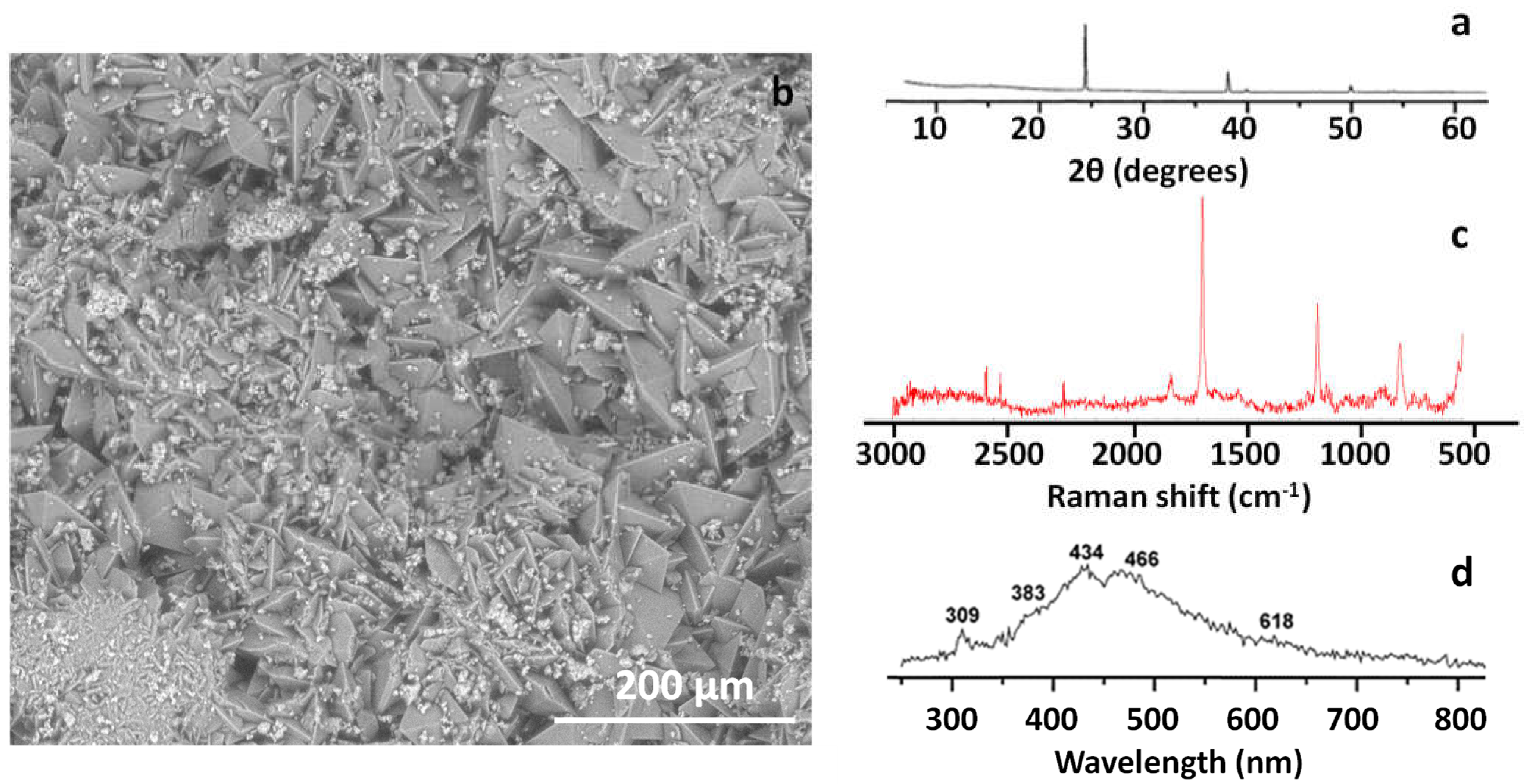 Kidney Stones: Crystal Characterization