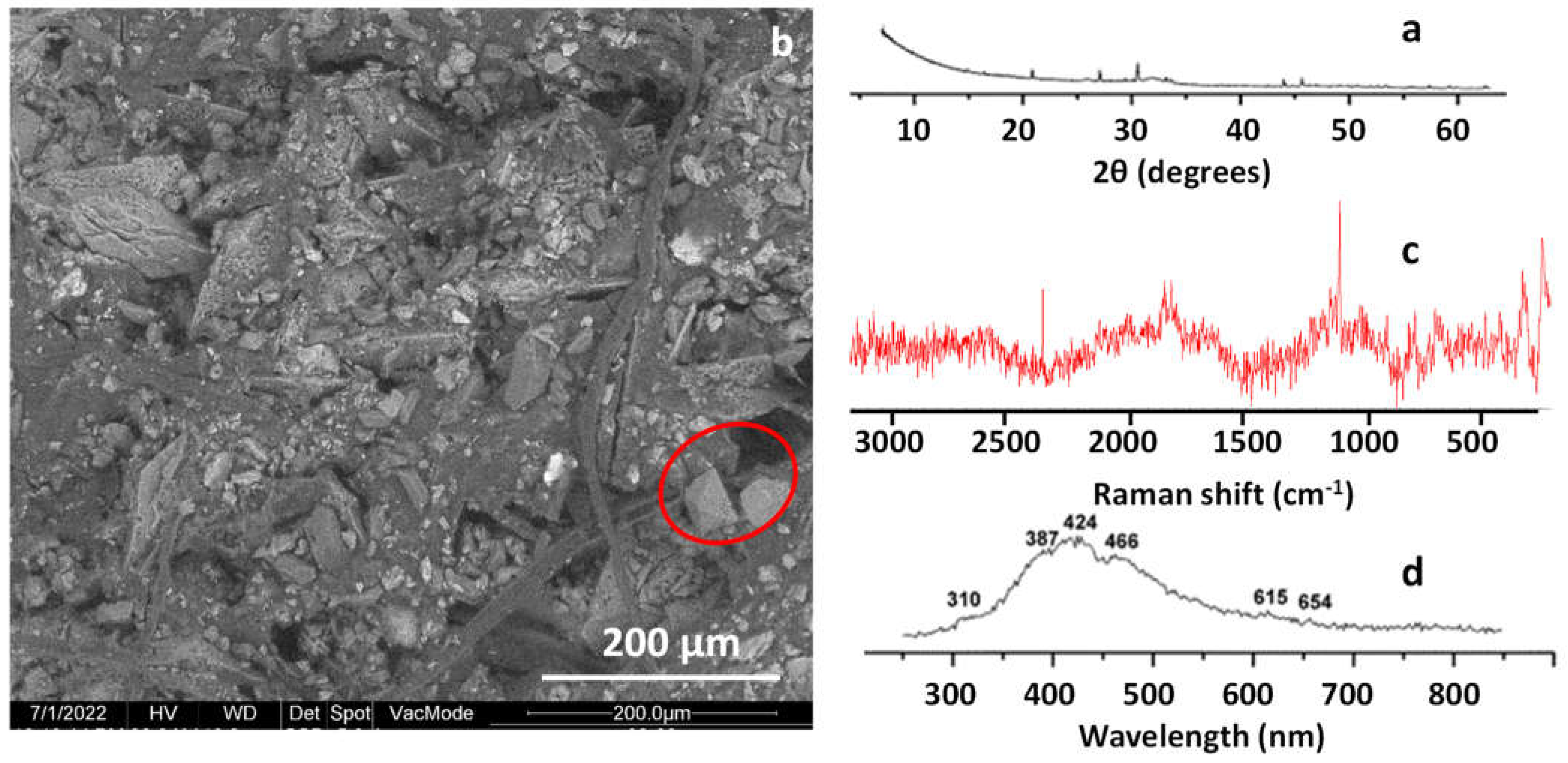 Kidney Stones: Crystal Characterization