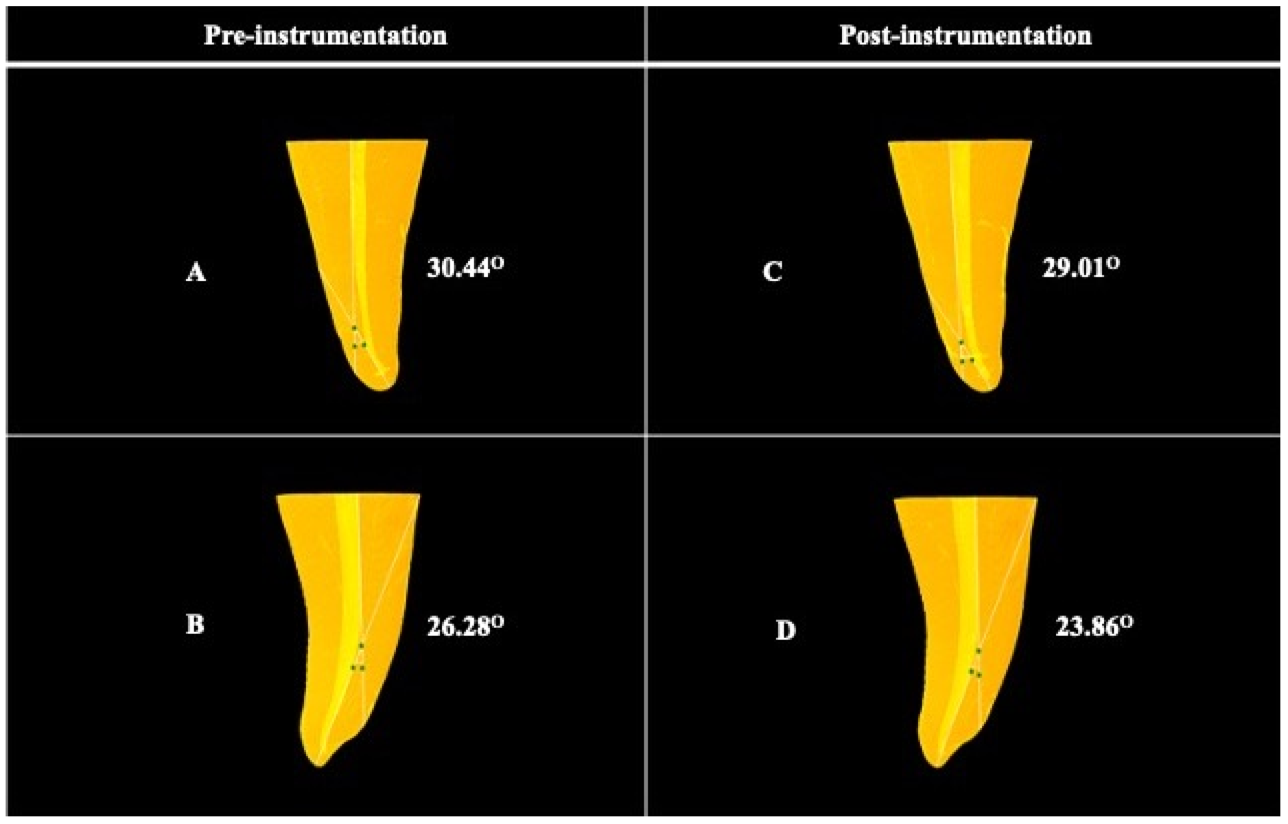Micro-Computed Tomographic Evaluation of the Shaping Ability of Vortex ...