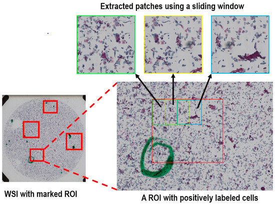 Detection of Cervical Cancer Cells in Whole Slide Images Using ...