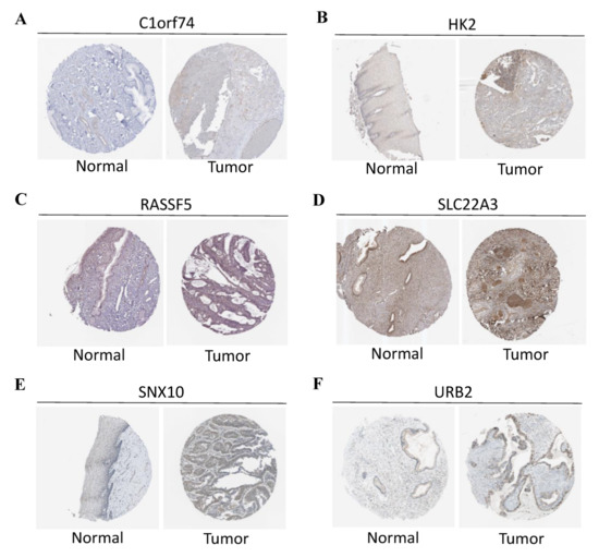 CircRNA-Based Cervical Cancer Prognosis Model, Immunological Validation ...