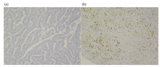 Current Oncology | Free Full-Text | LKB1 Loss Assessed by ...