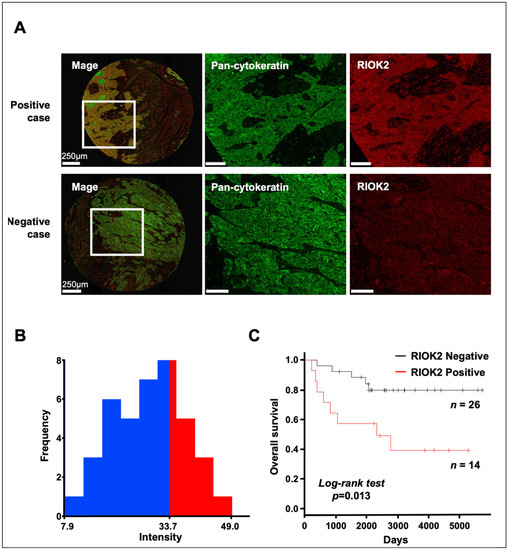RIOK2 Contributes to Cell Growth and Protein Synthesis in Human Oral ...