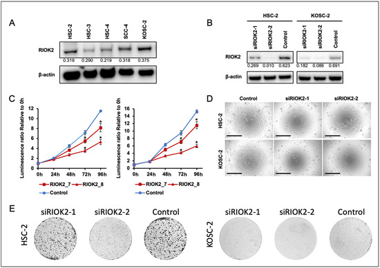 RIOK2 Contributes to Cell Growth and Protein Synthesis in Human Oral ...