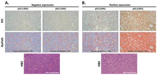 Current Oncology | Free Full-Text | Prognostic Significance of p53 and ...