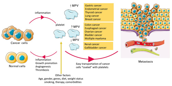 Relation of Mean Platelet Volume (MPV) with Cancer: A Systematic Review ...