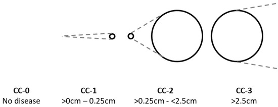 Intra-Abdominal Desmoplastic Small Round Cell Tumor (DSRCT) and the ...