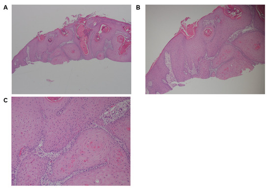 Current Oncology | Free Full-Text | Immune-Checkpoint Induced Skin ...