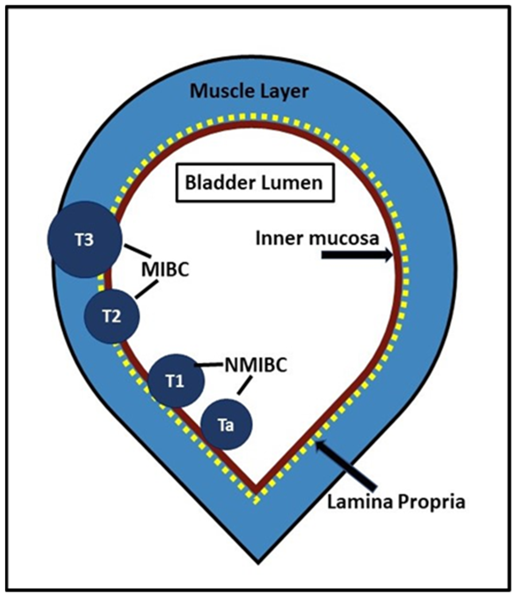 Intravesical Contrast-Enhanced MRI: A Potential Tool for Bladder Cancer ...