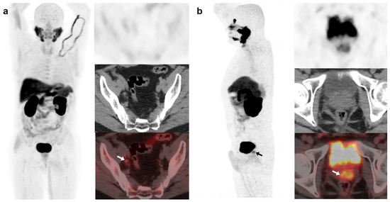 Current Oncology | Free Full-Text | Head-to-Head Comparison of [18F]F ...
