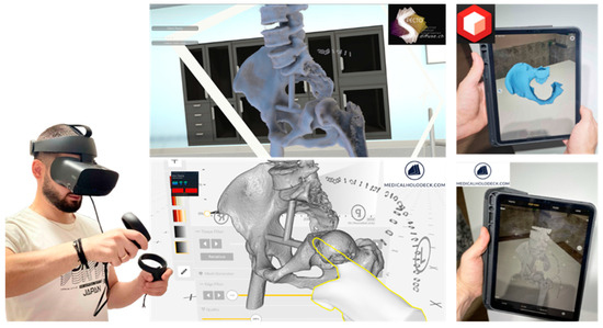 Point-of-Care Orthopedic Oncology Device Development
