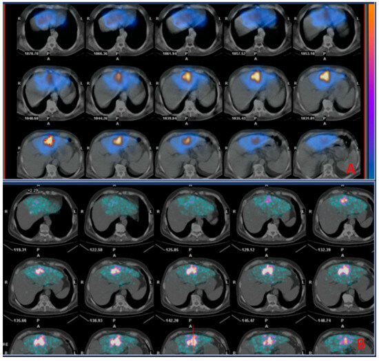 The Influence of Additional Treatments on the Survival of Patients ...