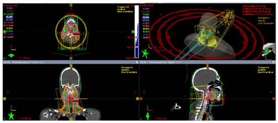 Interdisciplinary Collaboration in Head and Neck Cancer Care ...