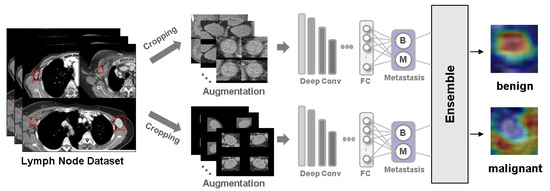 Deep Learning Prediction of Axillary Lymph Node Metastasis in Breast ...
