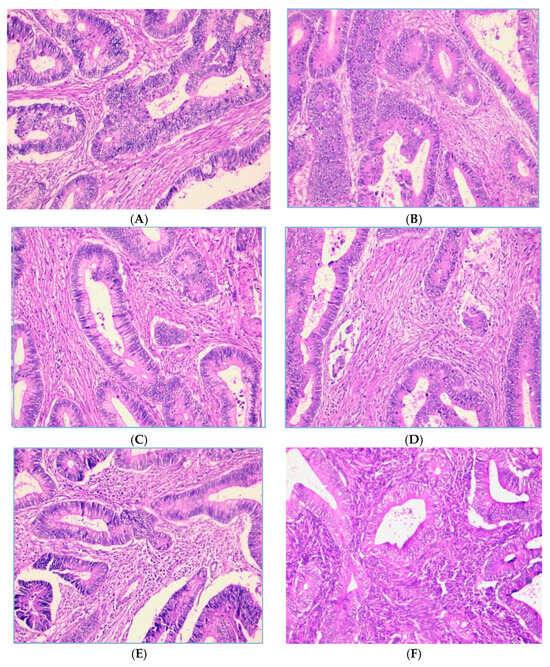 The Potential of PD-1 and PD-L1 as Prognostic and Predictive Biomarkers ...