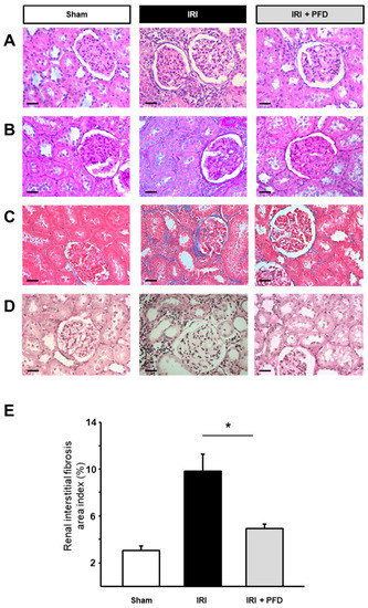 Pharmacological Blockade of TGF-Beta Reduces Renal Interstitial ...