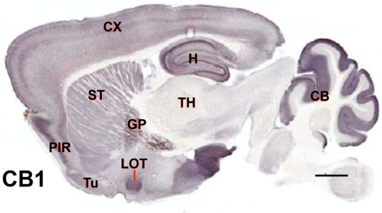 Requiem for Rimonabant: Therapeutic Potential for Cannabinoid CB1 ...