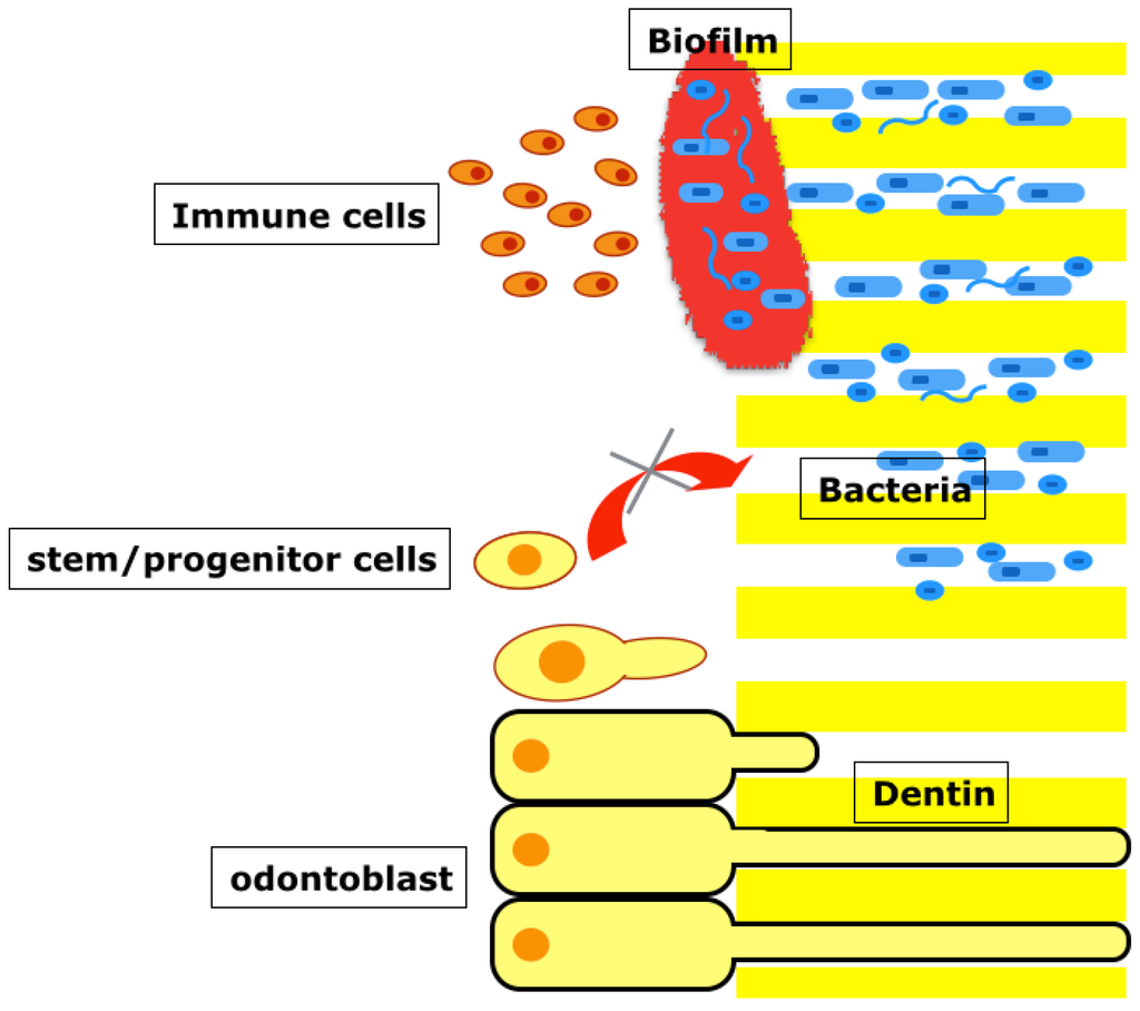 Infection and Pulp Regeneration