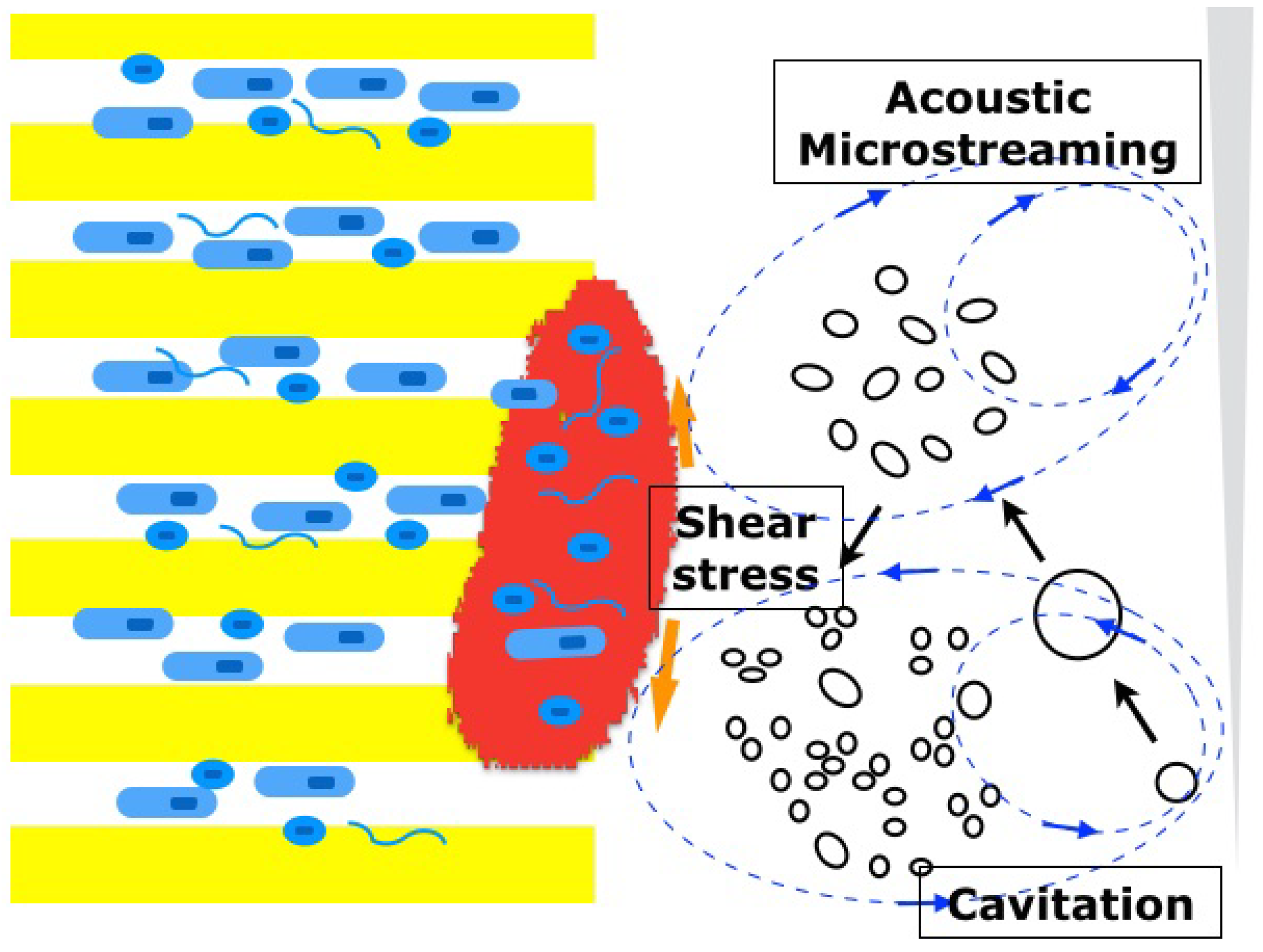 Infection and Pulp Regeneration