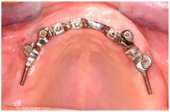 Dentistry Journal | Free Full-Text | Multicenter Retrospective Analysis ...