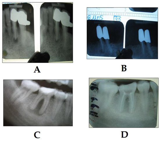 Dentistry Journal | Special Issue : Photobiomodulation