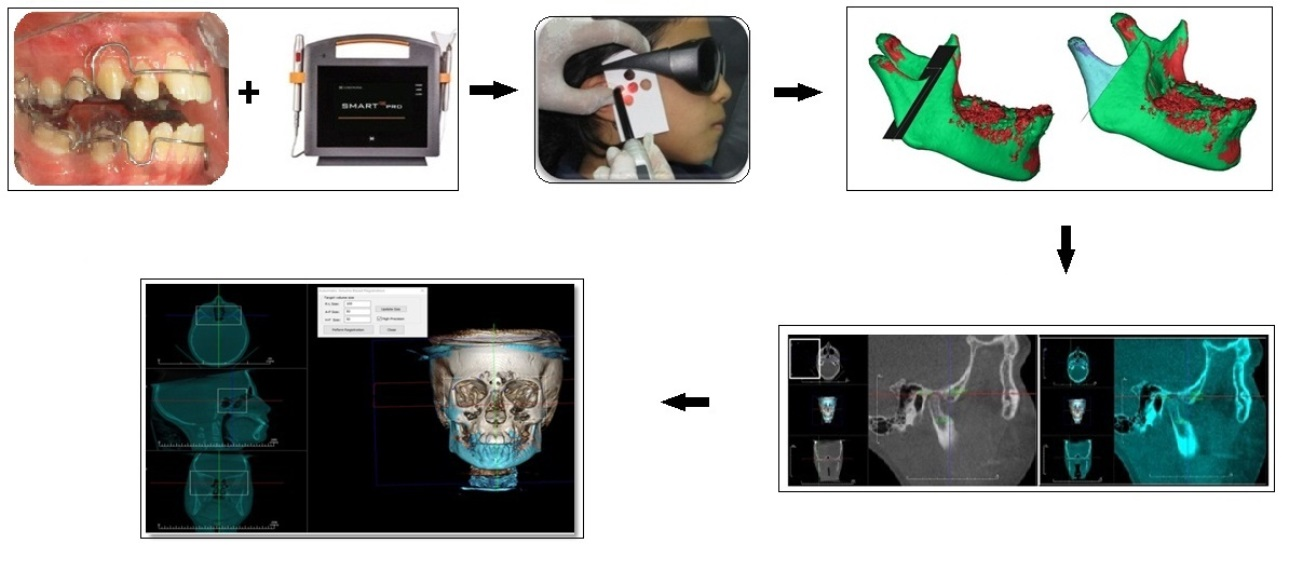 Dentistry Journal | Free Full-Text | Three-Dimensional Assessment of ...