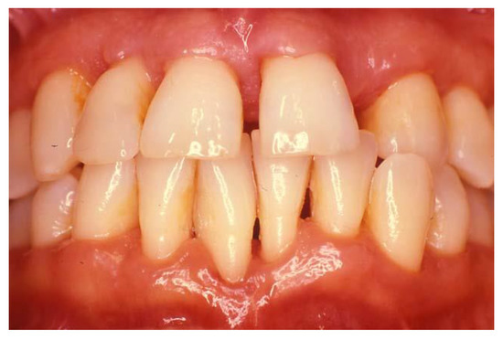 Periodontal Health and Systemic Conditions
