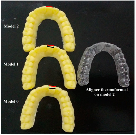 Primary Evaluation of Shape Recovery of Orthodontic Aligners Fabricated ...