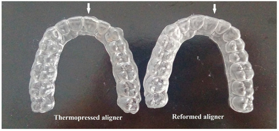Primary Evaluation of Shape Recovery of Orthodontic Aligners Fabricated ...