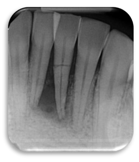Dentistry Journal | Free Full-Text | Sport and Dental Traumatology ...