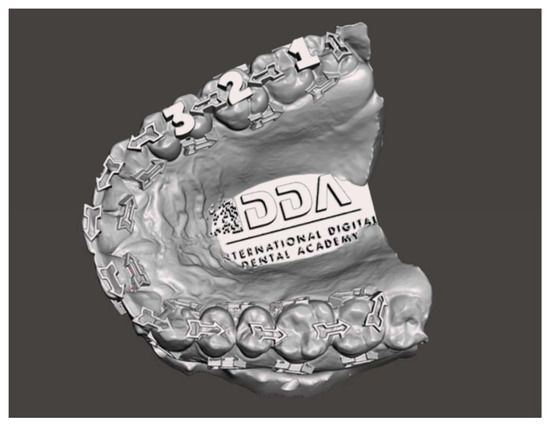 A Comparison of Full Arch Trueness and Precision of Nine Intra-Oral ...