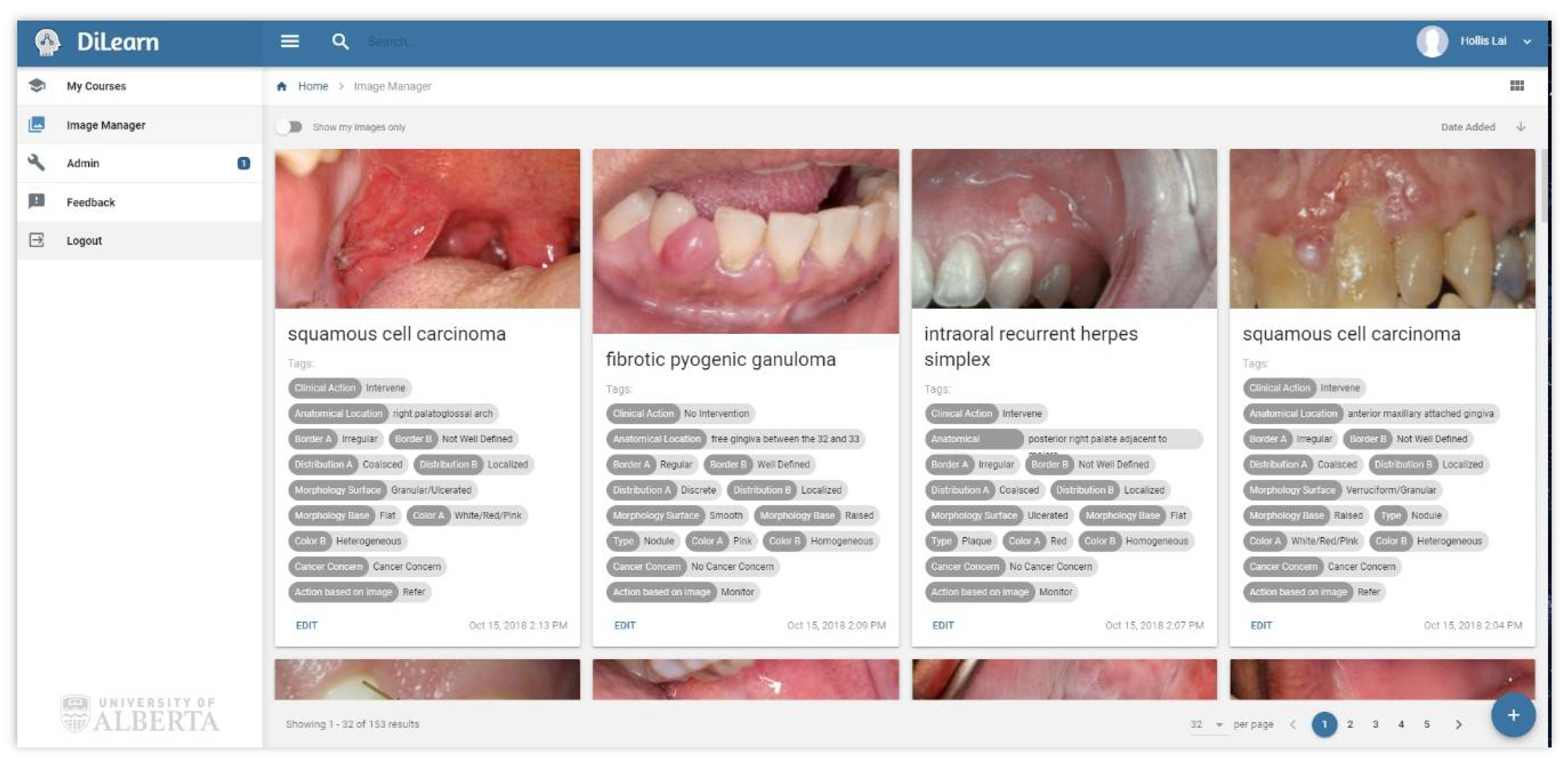 Evaluating Classification Consistency of Oral Lesion Images for Use in ...