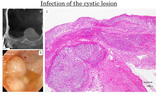 Dentistry Journal | Free Full-Text | A Reliable Surgical Procedure for ...