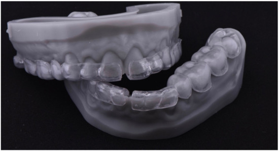 Dentistry Journal | An Open Access Journal from MDPI