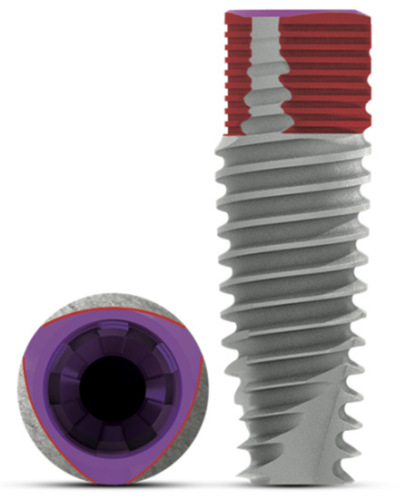 Dentistry Journal | Free Full-Text | Clinical and Radiographic ...